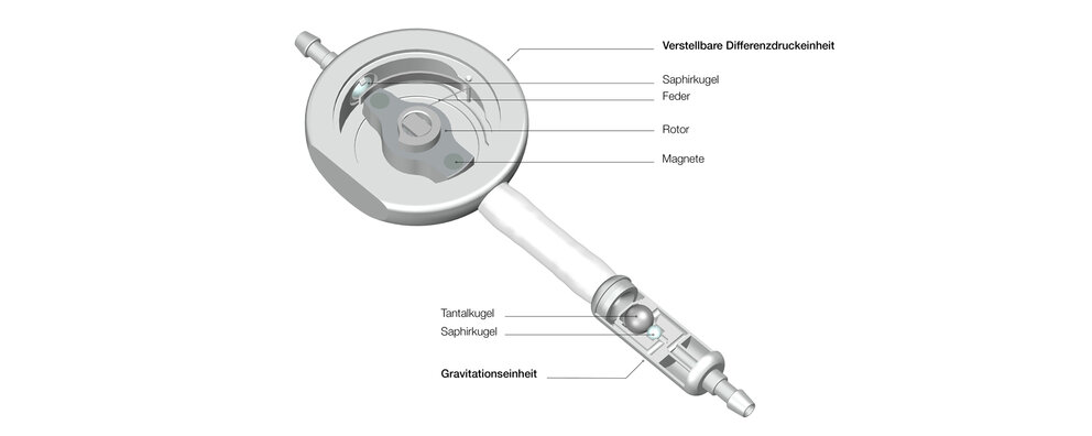 proGAV: Unser erstes verstellbares Ventil | MIETHKE