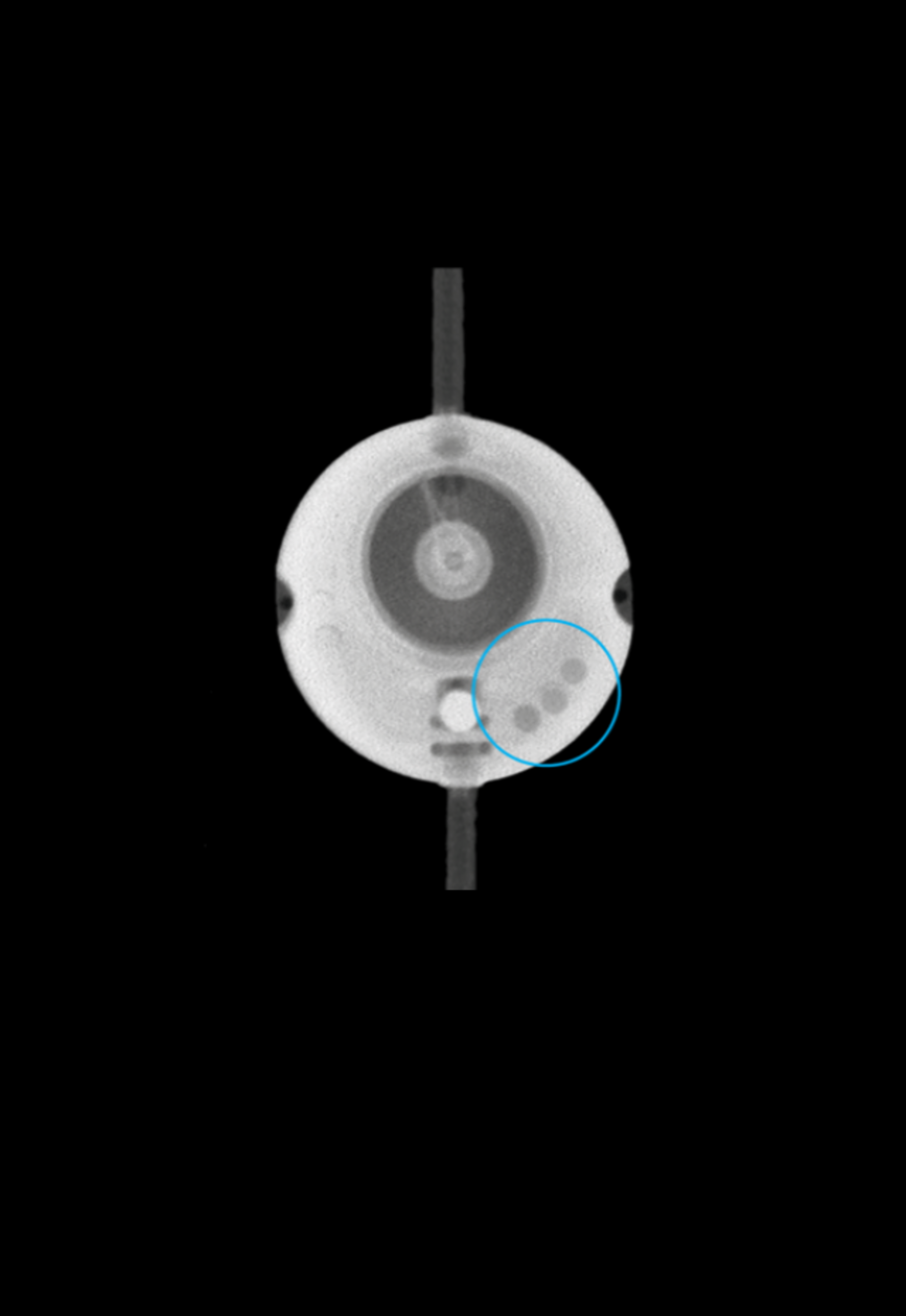 DUALSWITCH VALVE: The first MIETHKE valve :: Christoph Miethke GmbH ...