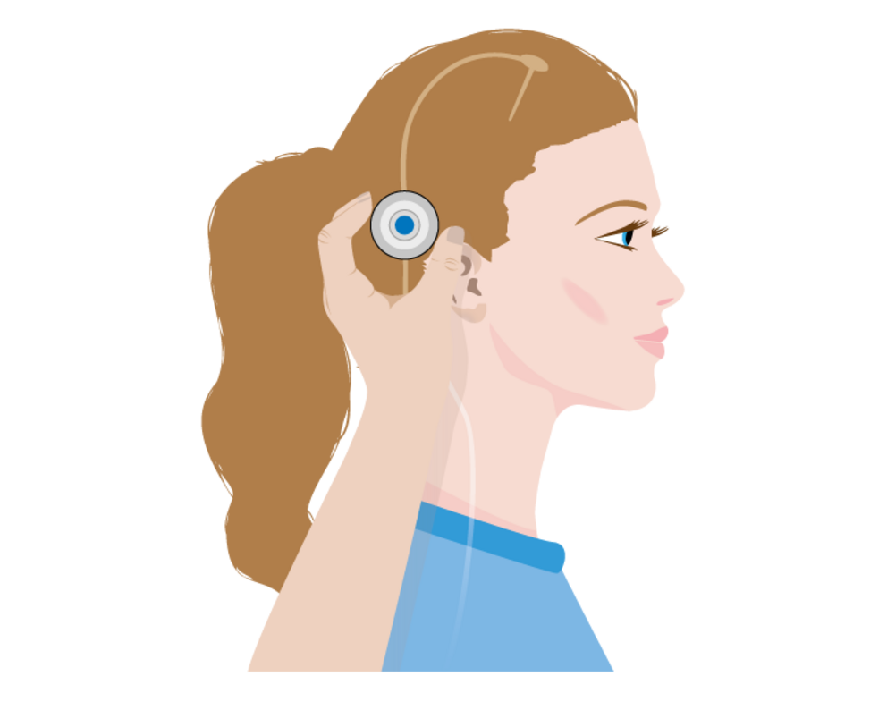 proGAV: Our first adjustable valve | MIETHKE