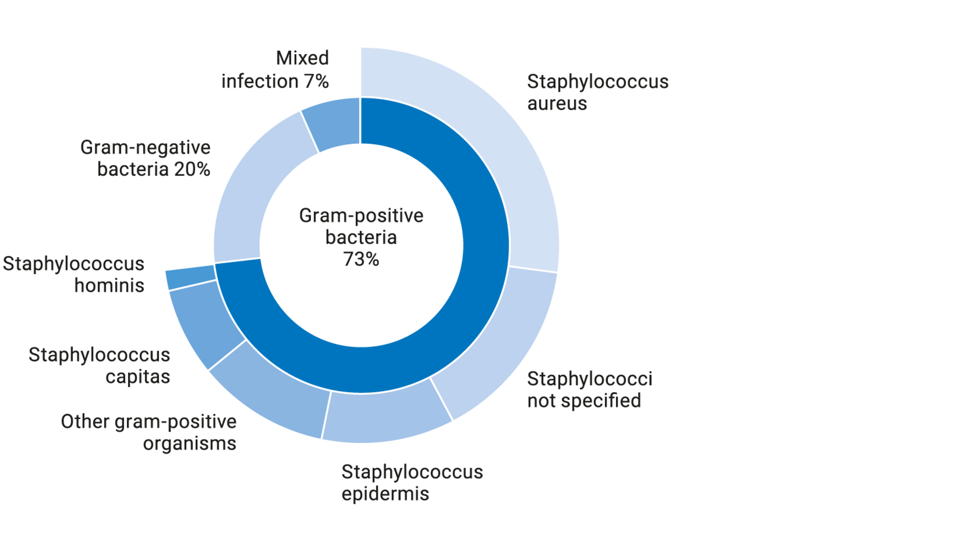 Hydrocephalus and shunt infection | MIETHKE