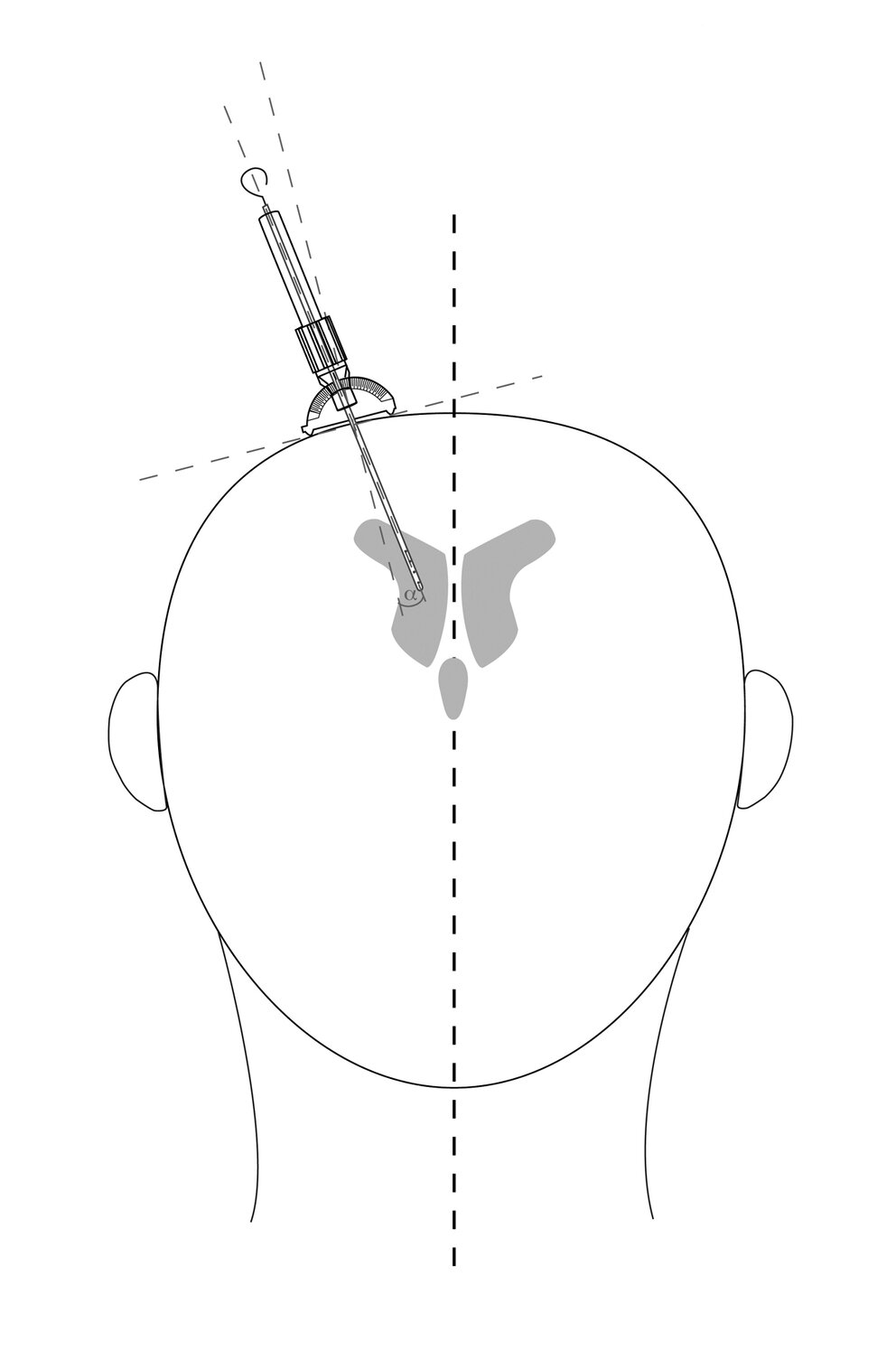 Thomale Guide | MIETHKE