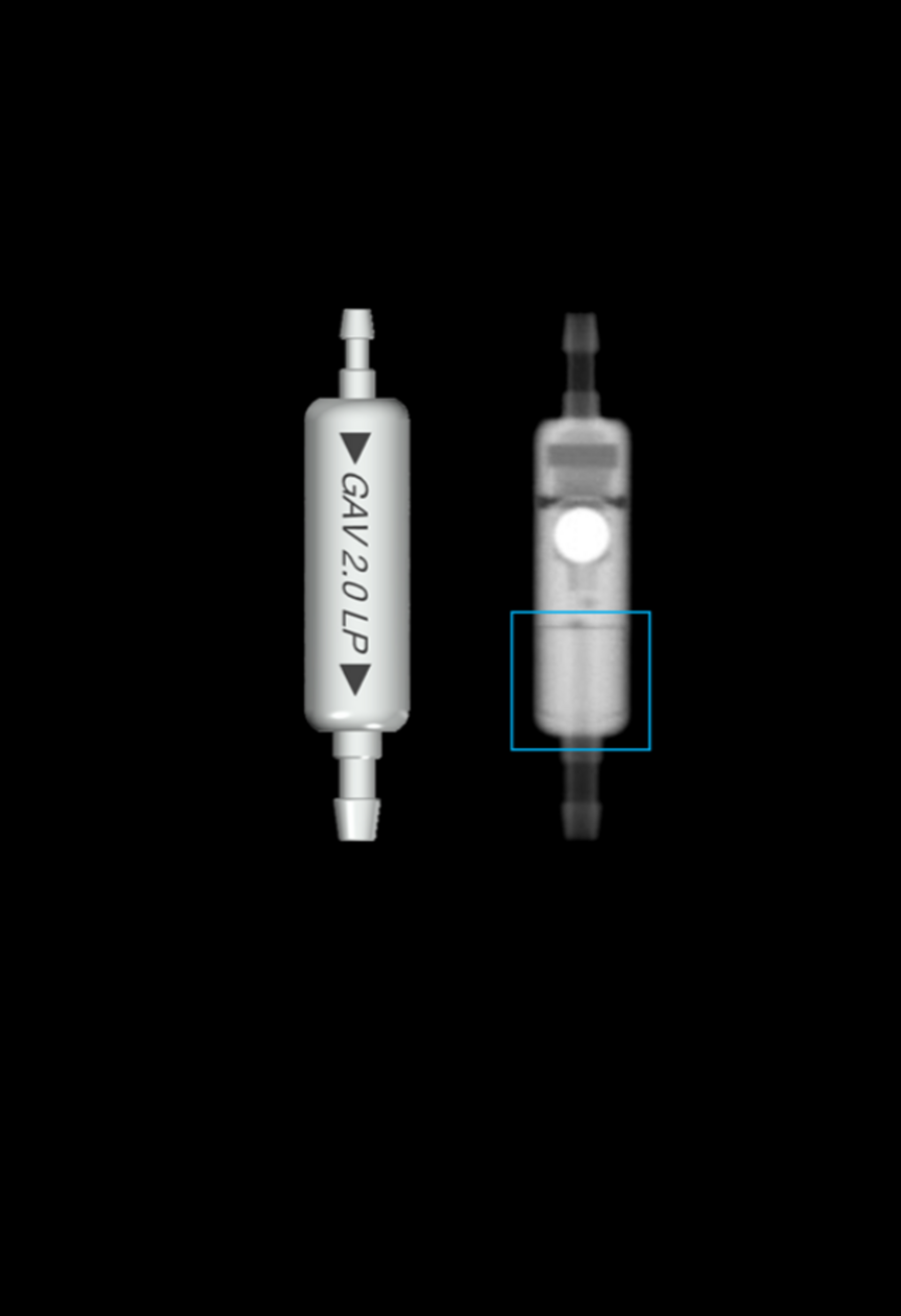 GAV 2.0: One hydrocephalus valve for all | MIETHKE