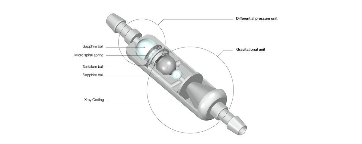 GAV 2.0: One hydrocephalus valve for all | MIETHKE