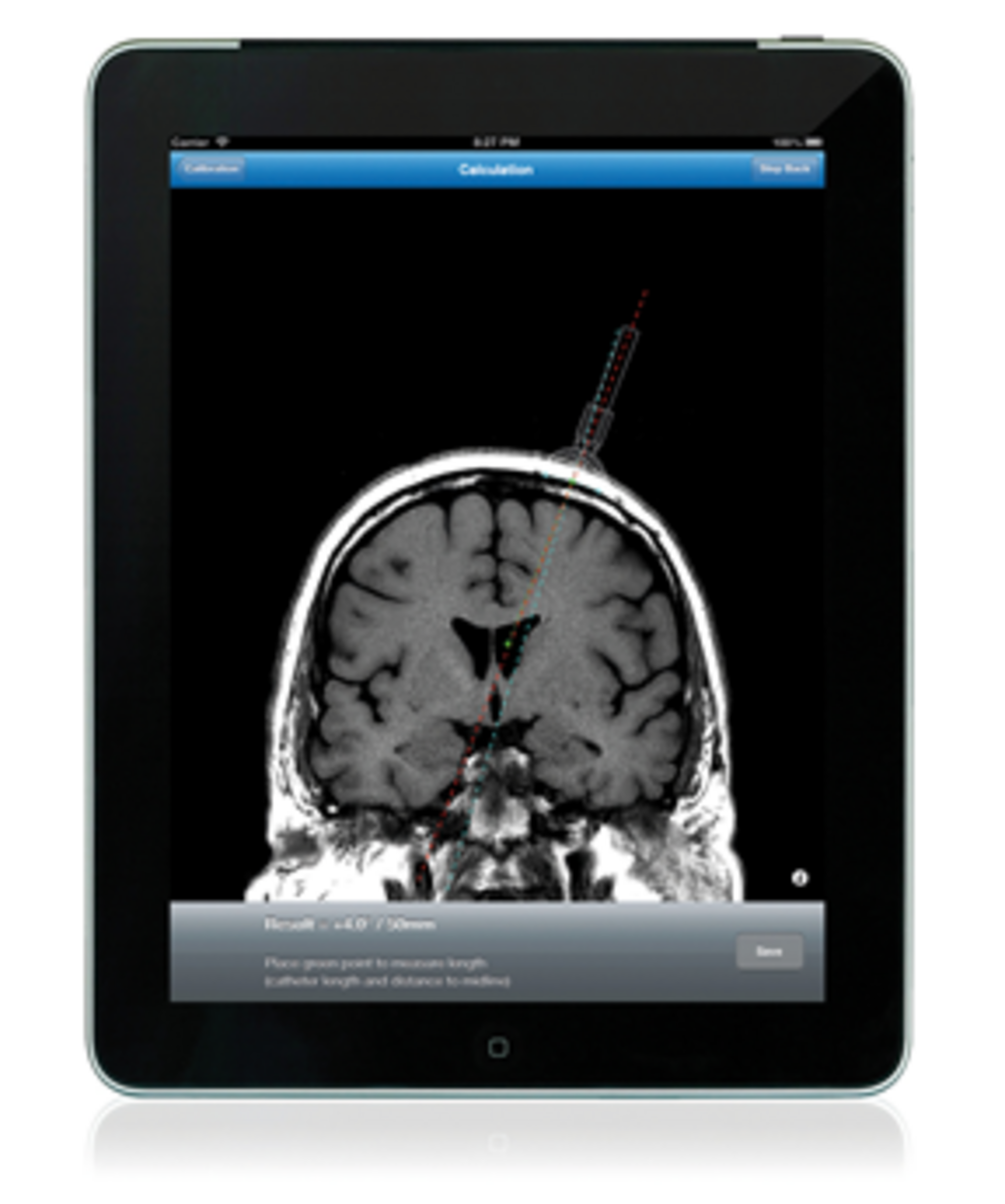 THOMALE GUIDE APP | MIETHKE