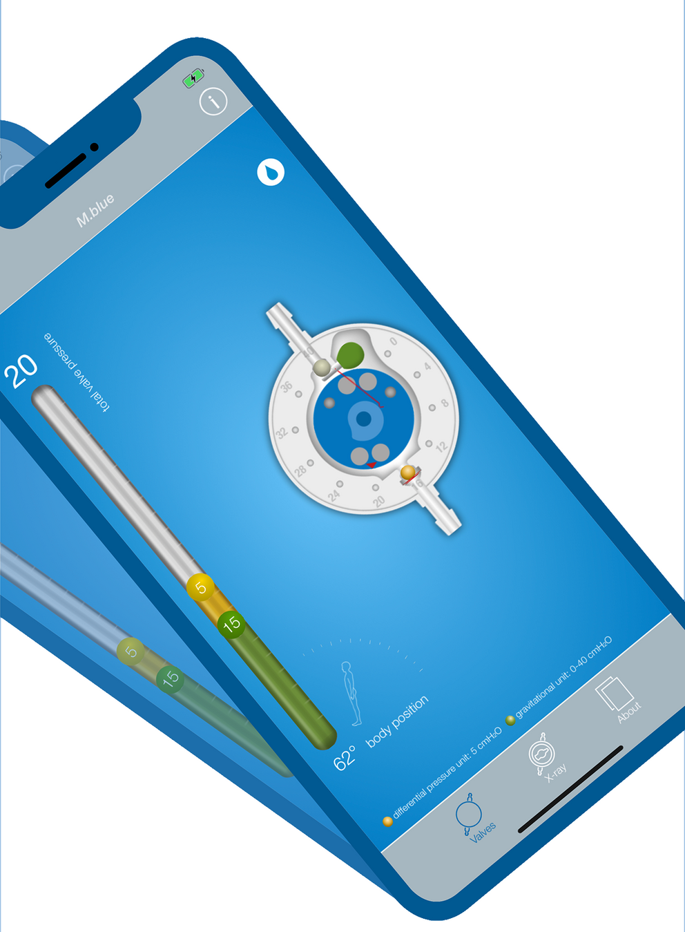 MIETHKE App: Understanding shunts | MIETHKE