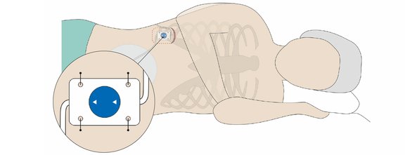 VALVE BOARD for gravitational valves | MIETHKE
