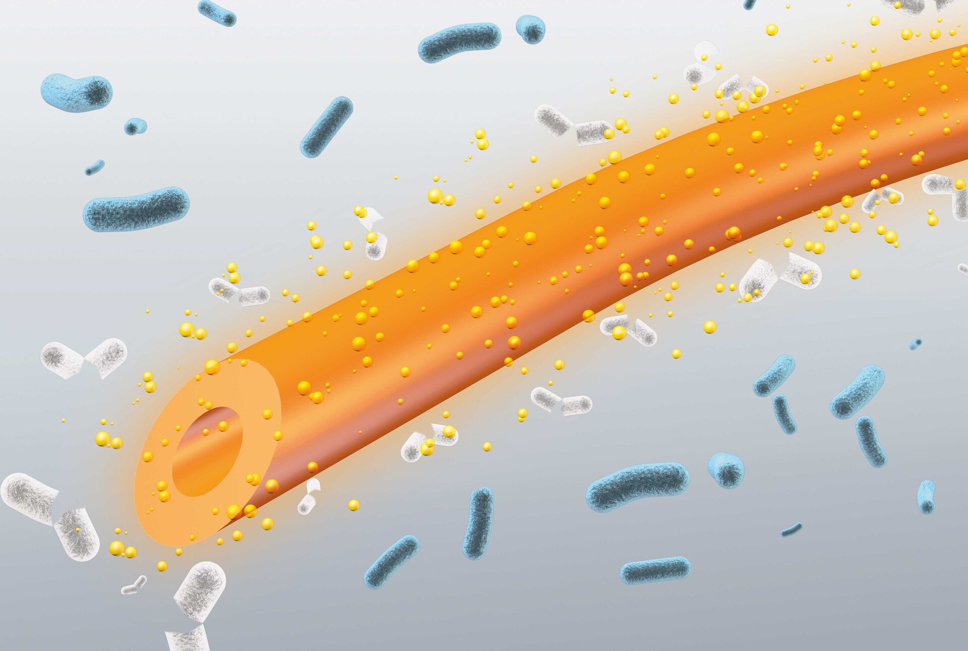 Hydrocephalus and shunt infection | MIETHKE