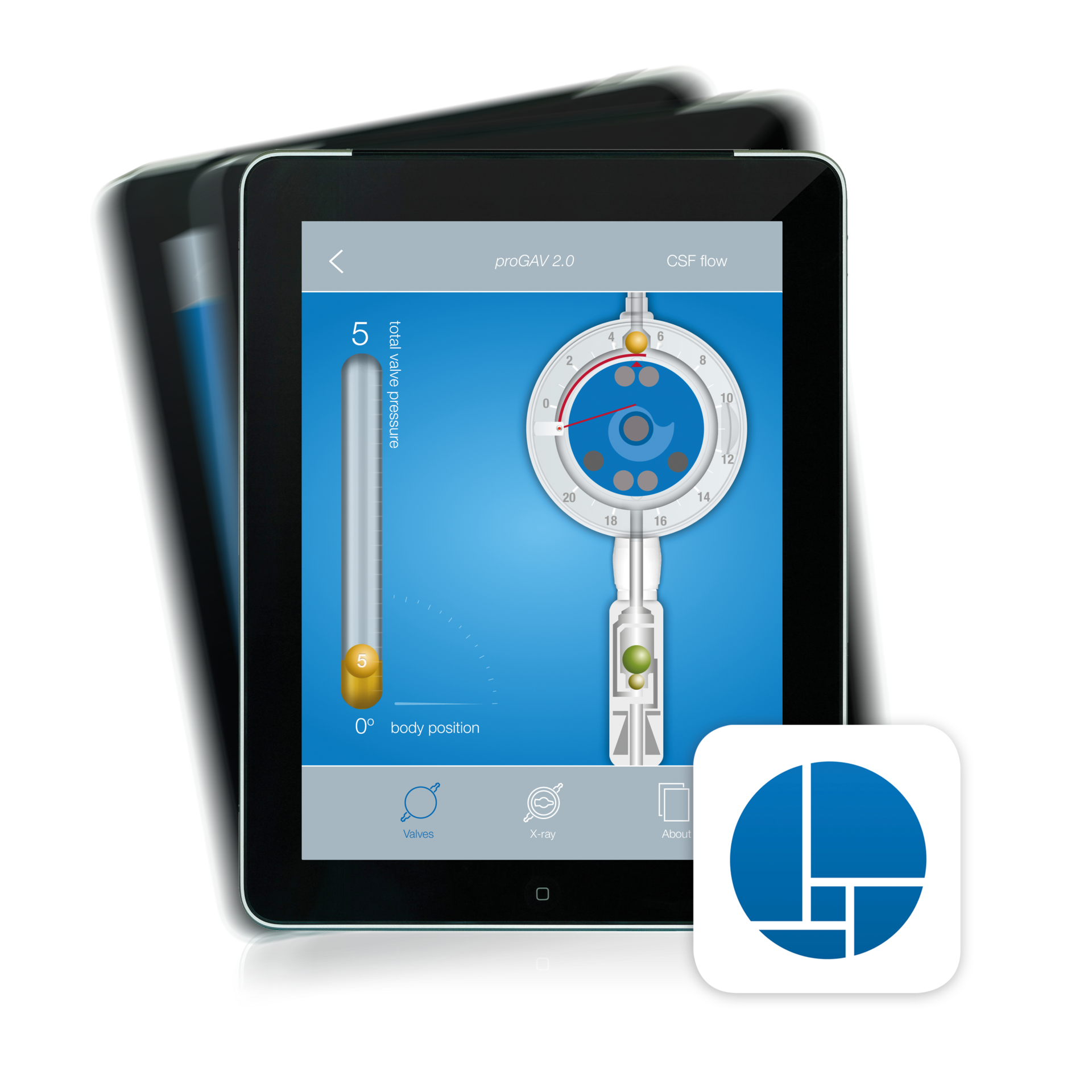 MIETHKE App: Understanding shunts | MIETHKE