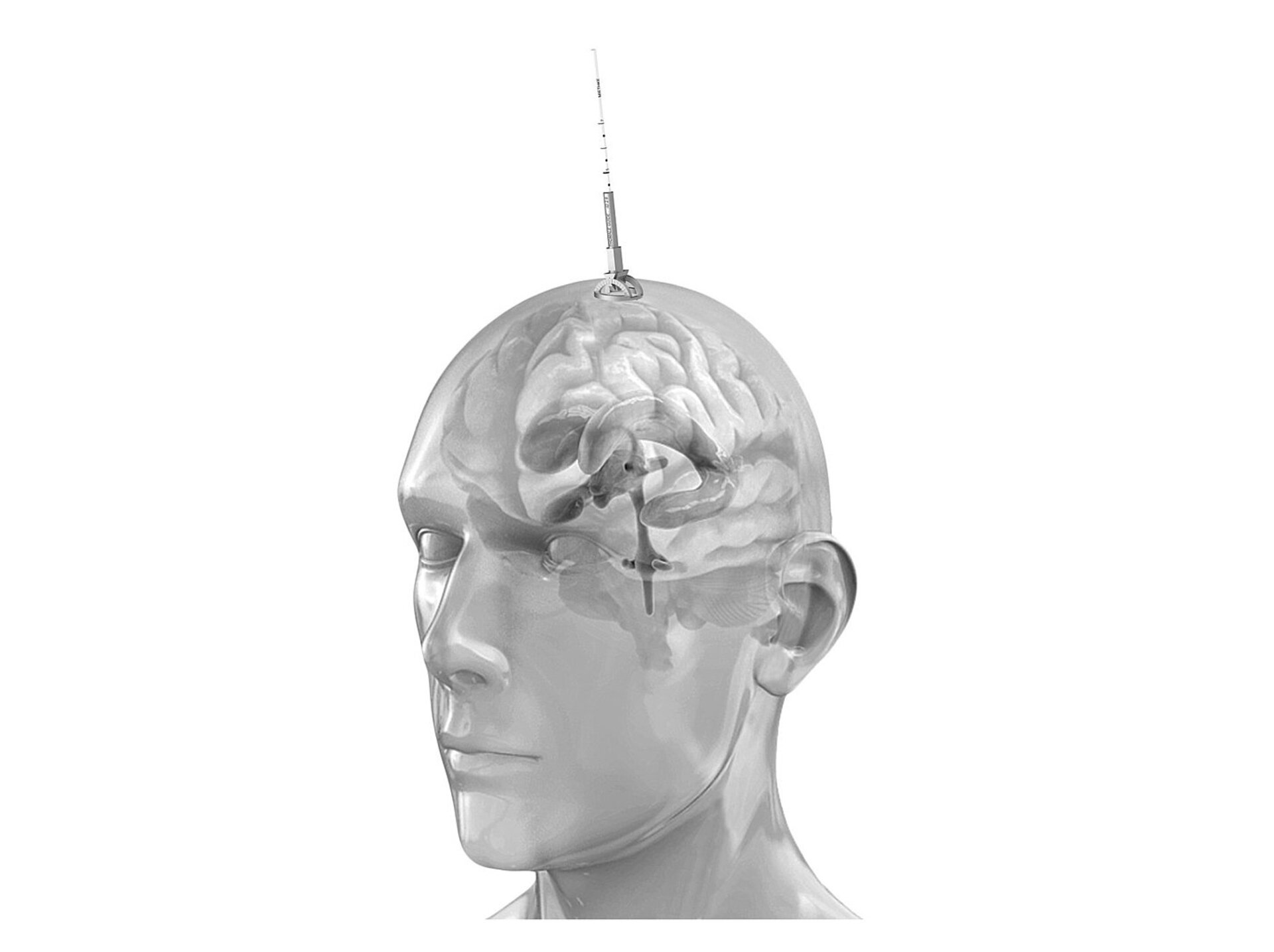 Thomale Guide | MIETHKE