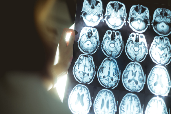 Hydrocephalus treatment :: Christoph Miethke GmbH & Co. KG